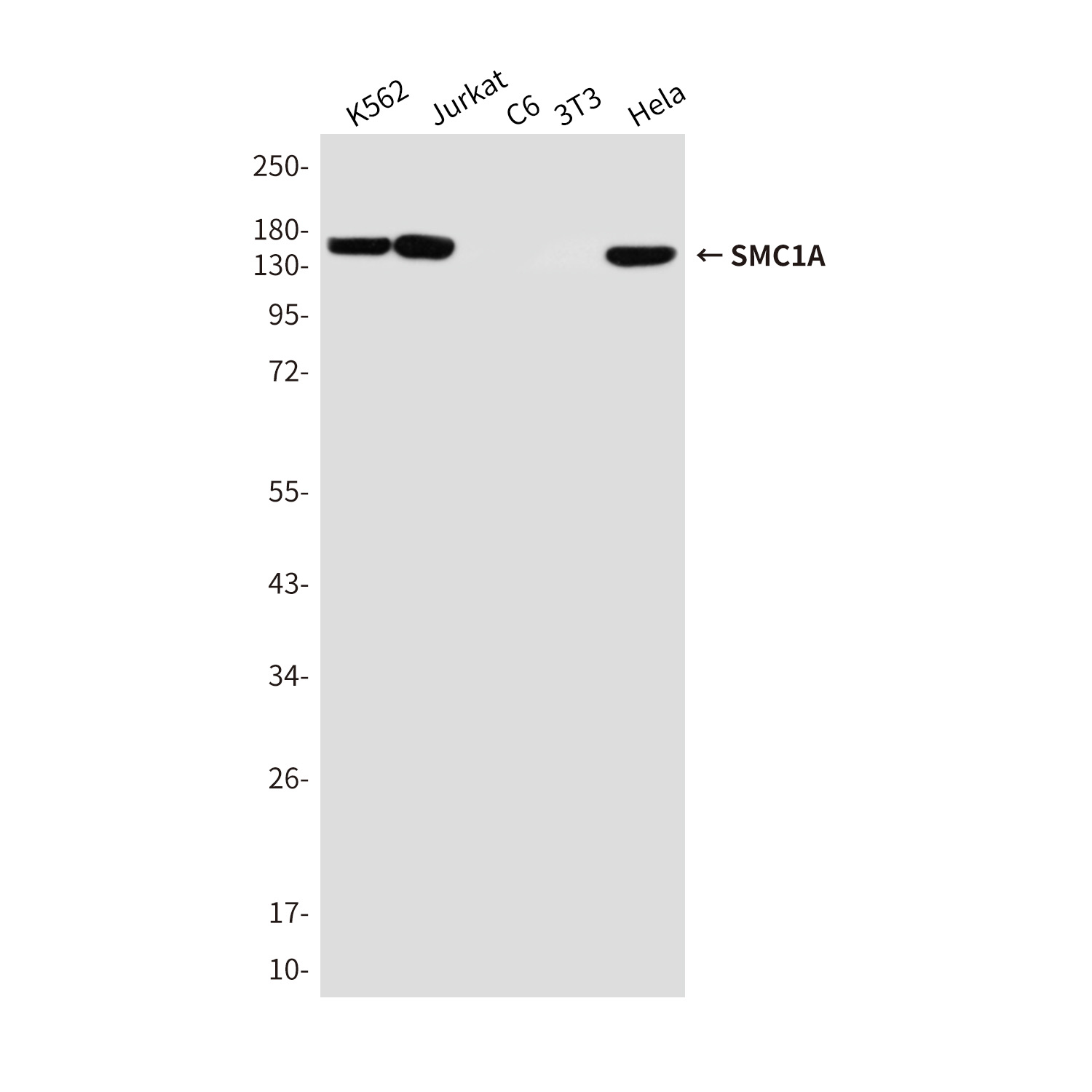 SMC1A Mouse mAb - diagbio | 戴格生物 - 抗体 蛋白 试剂盒
