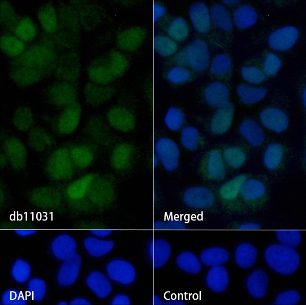 Androgen Receptor单克隆抗体(DGR12174) | 高特异性&高亲和力 | 戴格生物diagbio