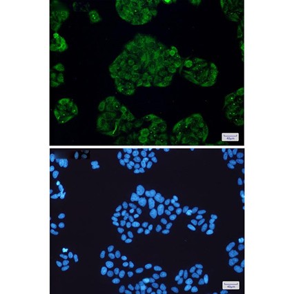 STUB1单克隆抗体(DGR13109) | 高特异性&高亲和力 | 戴格生物diagbio