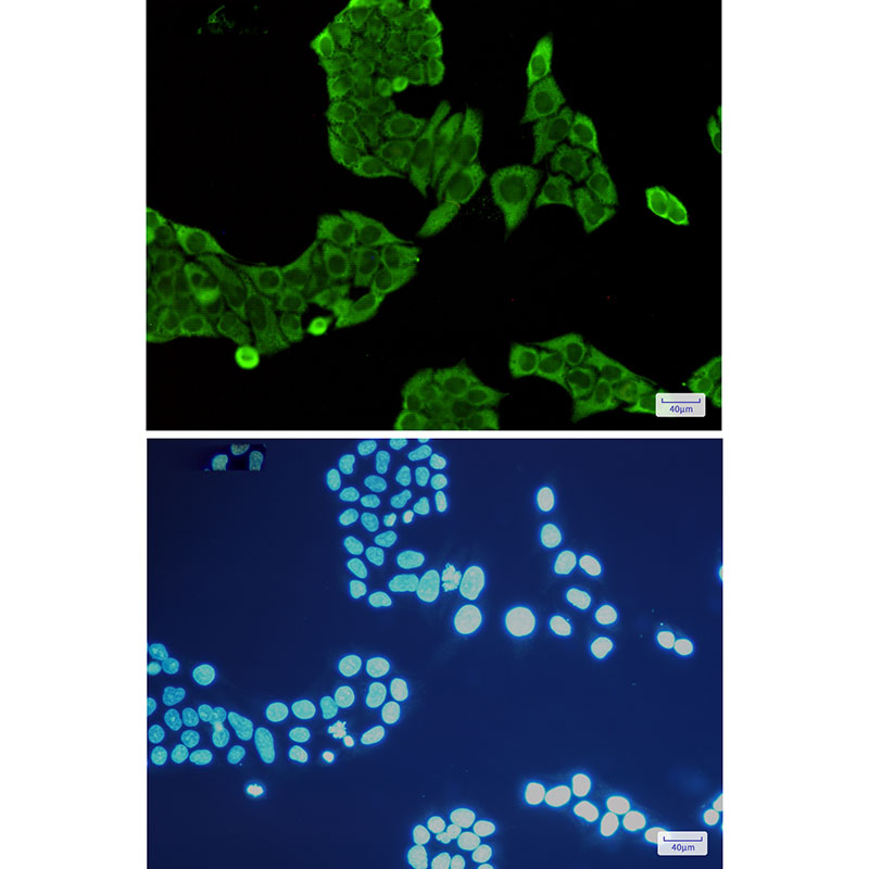 Annexin V单克隆抗体(DGR13165) | 高特异性&高亲和力 | 戴格生物diagbio
