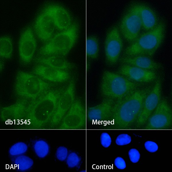 ERp18单克隆抗体(DGR32212) | 高特异性&高亲和力 | 戴格生物diagbio