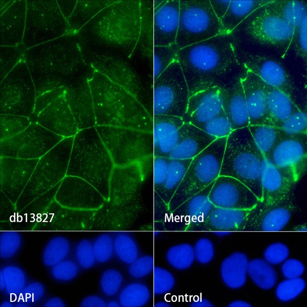 Carcino Embryonic Antigen CEA单克隆抗体(DGR31230) | 高特异性&高亲和力 | 戴格生物diagbio