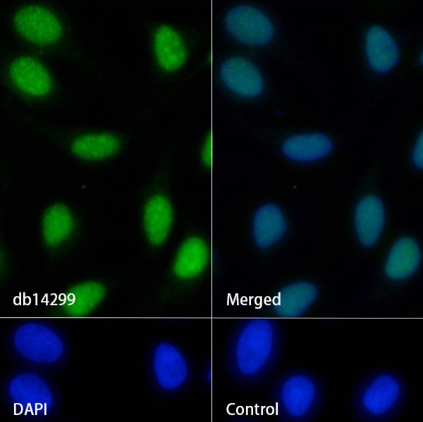 RBMX2单克隆抗体(DGR20326) | 高特异性&高亲和力 | 戴格生物diagbio