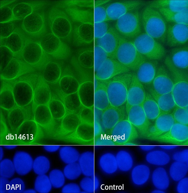 Cytochrome P450 1A2单克隆抗体(DGR18901) | 高特异性&高亲和力 | 戴格生物diagbio