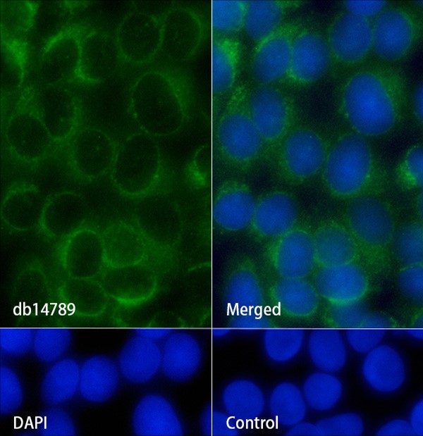 LMCD1单克隆抗体(DGR16816) | 高特异性&高亲和力 | 戴格生物diagbio