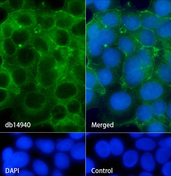 GCDFP 15单克隆抗体(DGR16009) | 高特异性&高亲和力 | 戴格生物diagbio