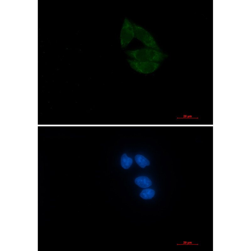 NUP155单克隆抗体(DGR32439) | 高特异性&高亲和力 | 戴格生物diagbio