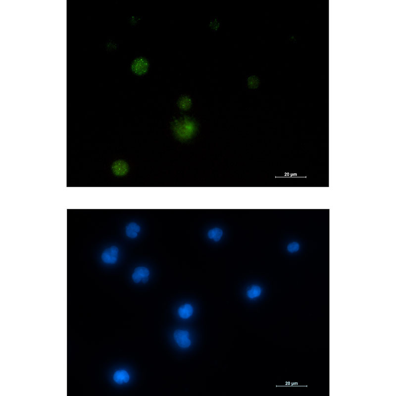 HNRNPUL1单克隆抗体(DGR18740) | 高特异性&高亲和力 | 戴格生物diagbio