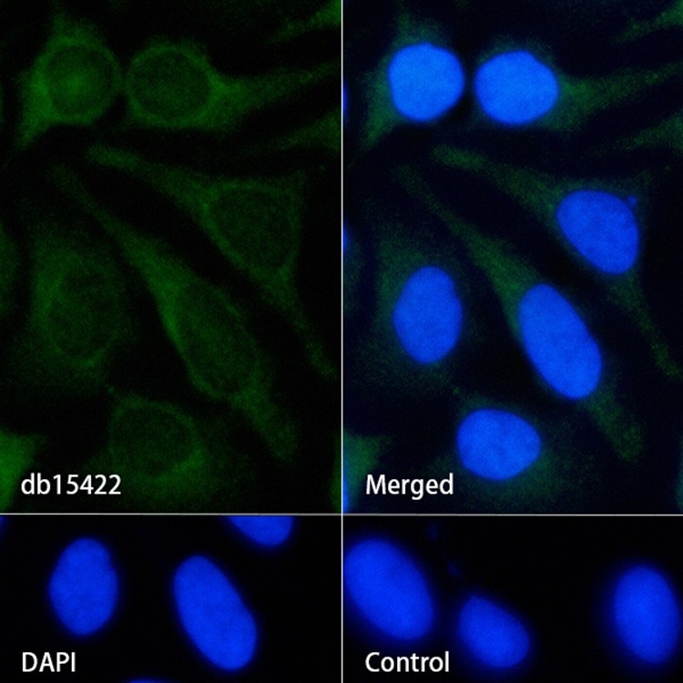MSI2单克隆抗体(DGR14116) | 高特异性&高亲和力 | 戴格生物diagbio