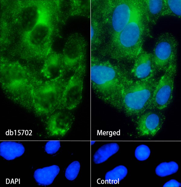Cathepsin D单克隆抗体(DGR12869) | 高特异性&高亲和力 | 戴格生物diagbio