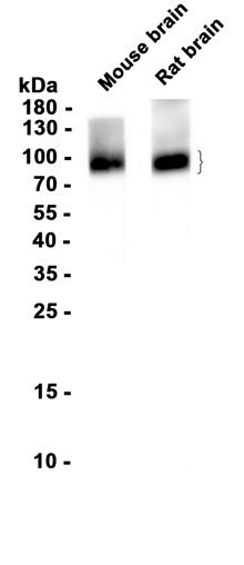 SV2A (DGR34850) Rabbit mAb - diagbio | 戴格生物 - 抗体 蛋白 试剂盒